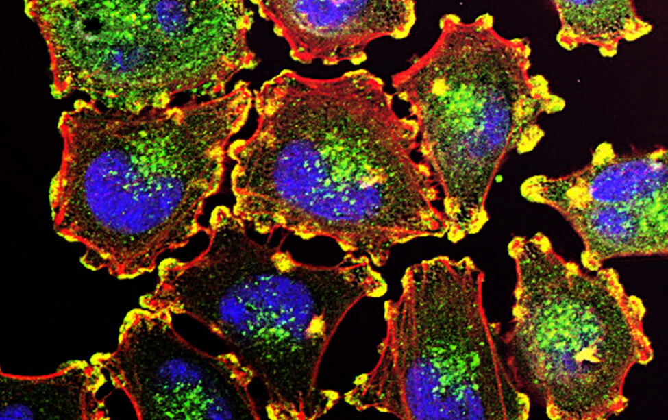Index Microscope Photos | 顯微觀點
